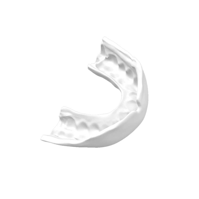 3D Printed Mouthguards - Damage Control Mouthguards